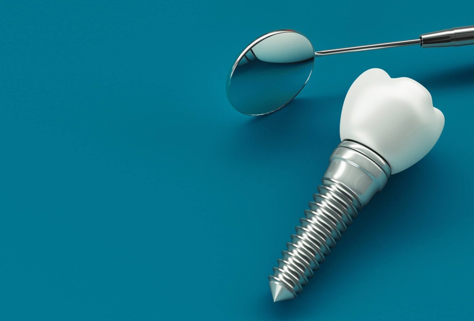Du hast NEU ein Implantat gesetzt bekommen – … und jetzt ...